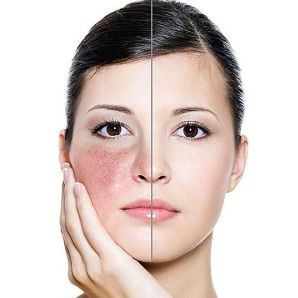 EasypayKw | أدوية الأمراض الجلدية